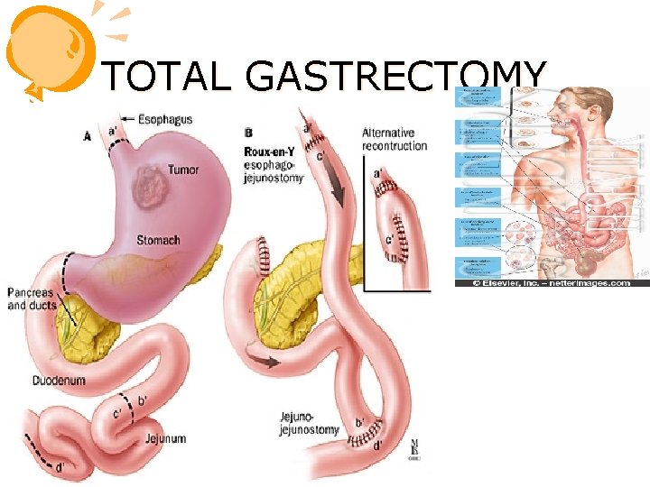BY REEJA RASHEED REEJA RASHEED 2002 BATCH 2002