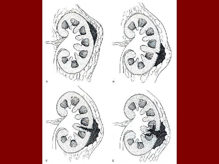 Renal Trauma Dr Ibrahim Barghouth Background 1 5