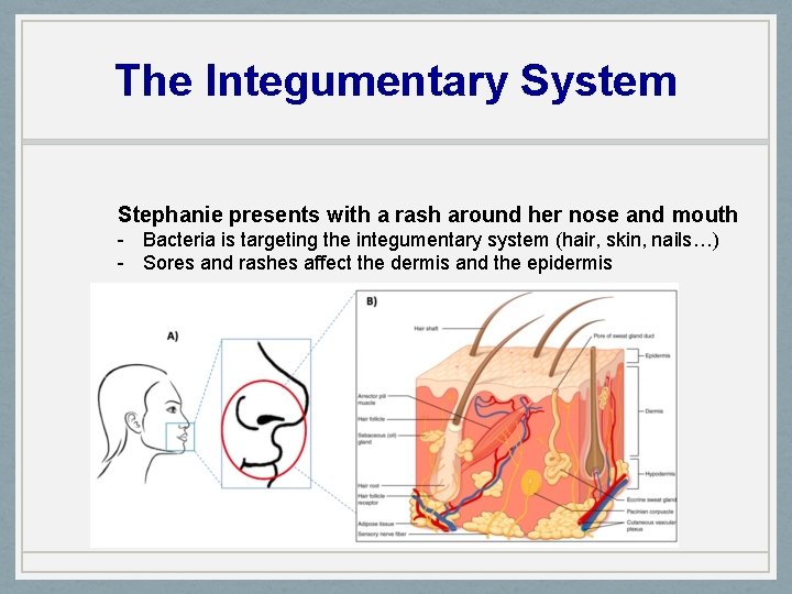 Body Systems Case 1 School Sores Gram stain