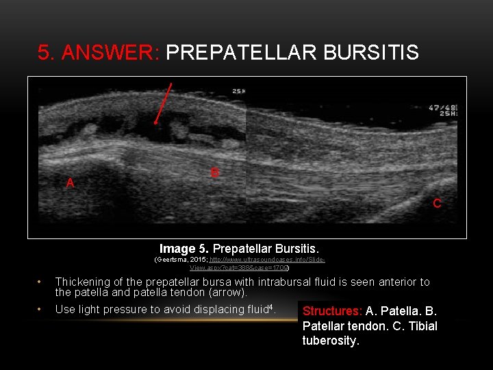 ULTRASOUND OF THE KNEE Pathology Flash Cards Emma