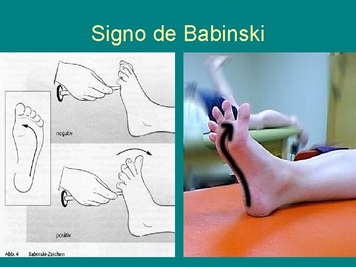 NEURONA MOTORA Dalia Rizo MPSS MOVIMIENTO La actividad