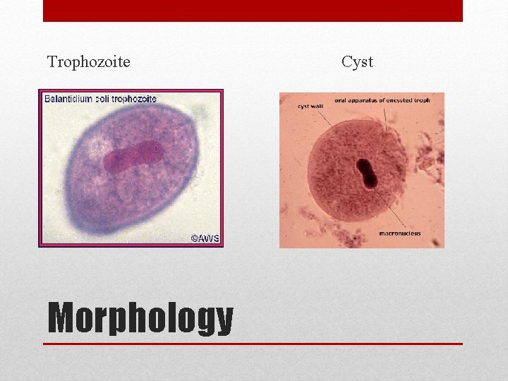 Ciliates and Flagellates Balantidium coli Giardia lamblia and