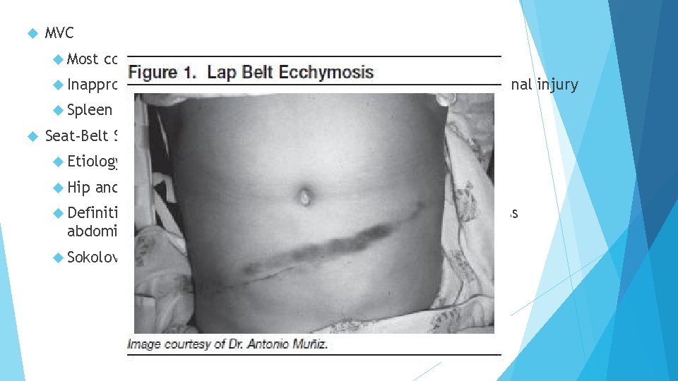 Pediatric Blunt Abdominal Trauma Does this patient need