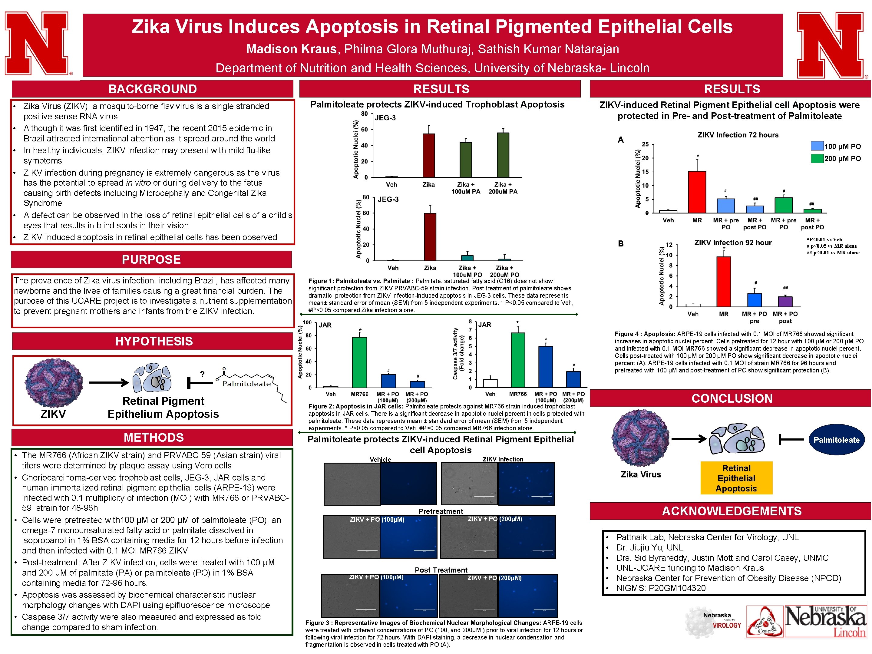 Zika Virus Induces Apoptosis in Retinal Pigmented Epithelial