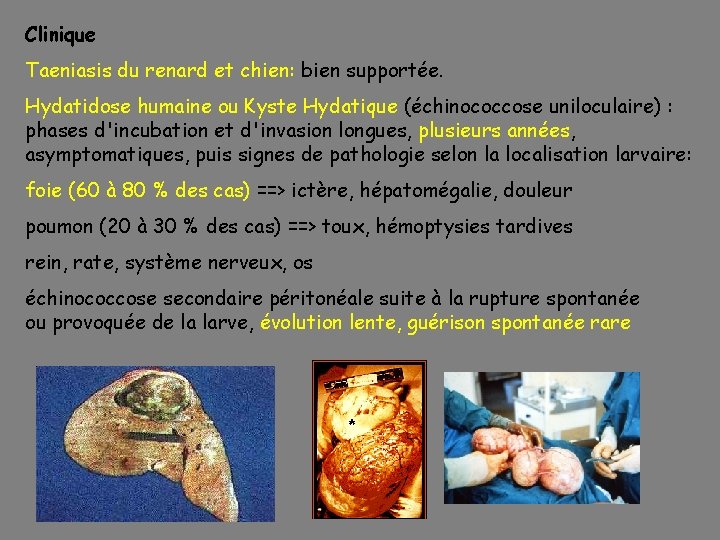 COURS DE PARASITOLOGIE DUT ABB 4 Les Cestodes