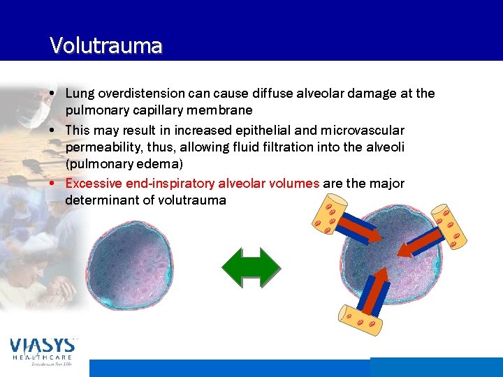HFOV Theory of Operation and Controls Disclosure Slides