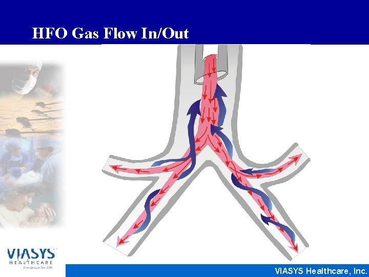 HFOV Theory of Operation and Controls Disclosure Slides