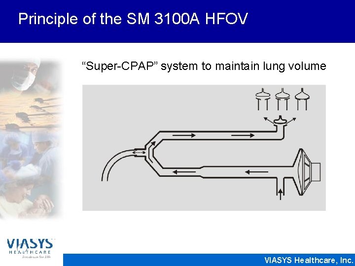 HFOV Theory of Operation and Controls Disclosure Slides