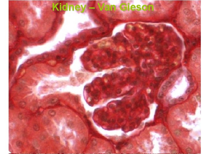 Urinary system Systema urinarium Kidneys Renes Overview of