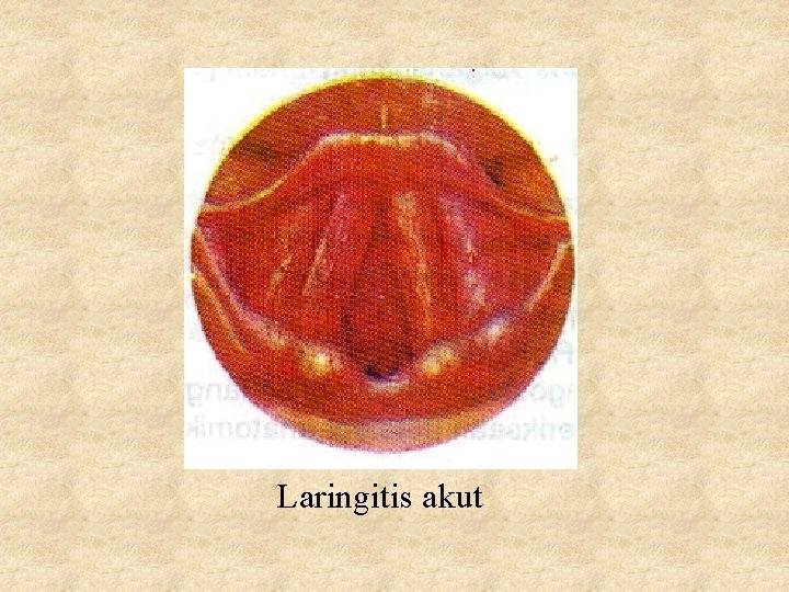 PENYAKIT FARING DAN LARING Dr BASTIANA M Kes