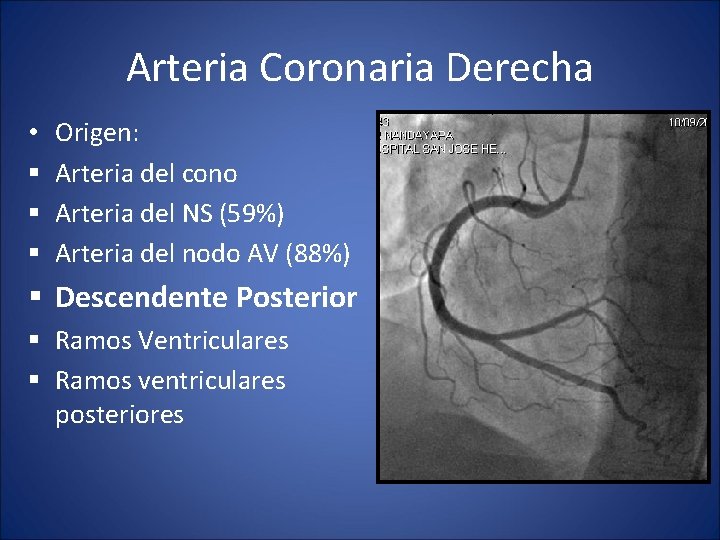 Anatoma Coronaria Dr Ricardo Gutirrez Leal Cardilogo Intervencionista