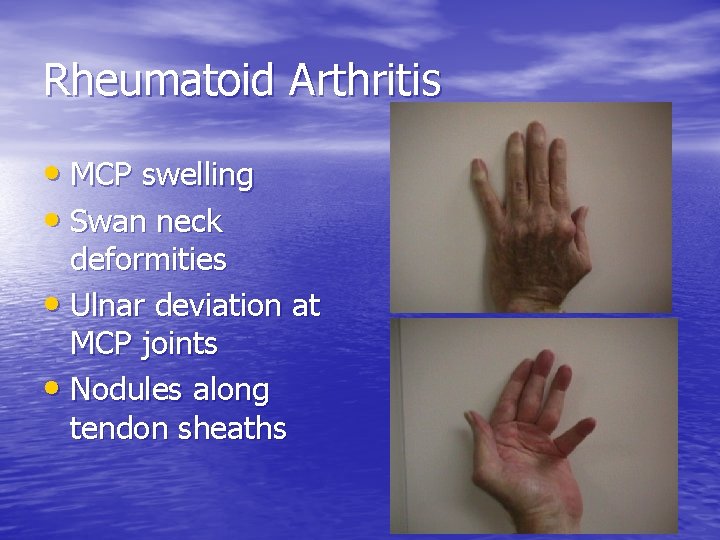 OBJECTIVES Review the clinical anatomy and physical exam