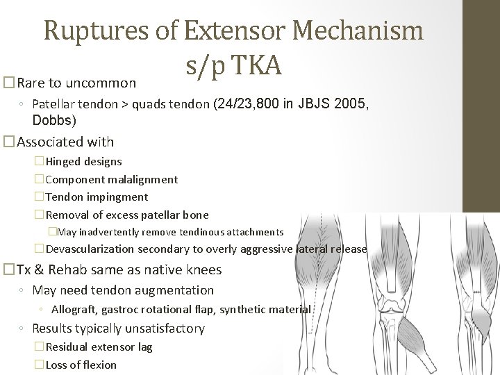 Quadriceps Patellar Tendon Injuries Ian Rice MD Introduction