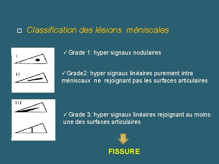 ATLAS IRM DES LESIONS MENISCO LIGAMENTAIRES DU GENOU