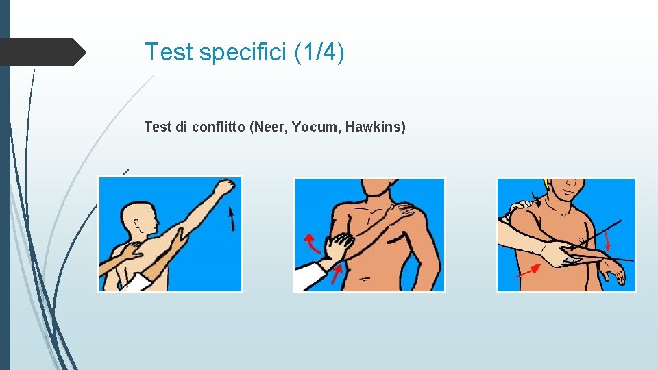 Diagnosi e indicazioni al trattamento del dolore di