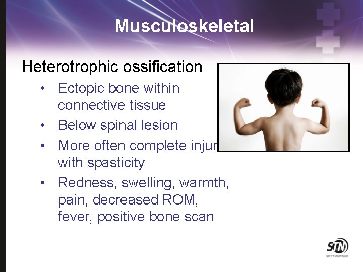 Spinal Column and Spinal Cord Injuries Objectives At