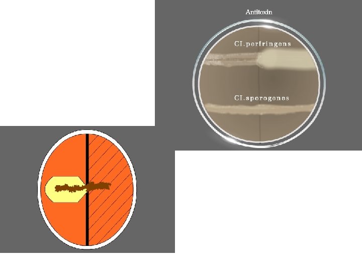 CLOSTRIDIUM PERFRINGENS Clos welchii CLOSTRIDIUM WELCHII Ng c