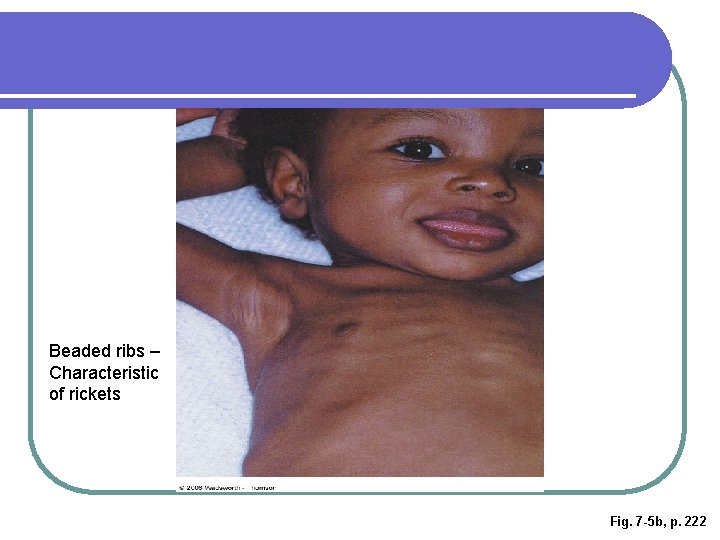 VITAMINS Definition and Classification l Noncaloric organic nutrients