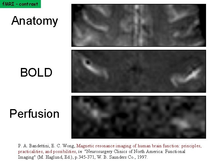 Magnetic Resonance Methods for Functional and Anatomical Neuroimaging