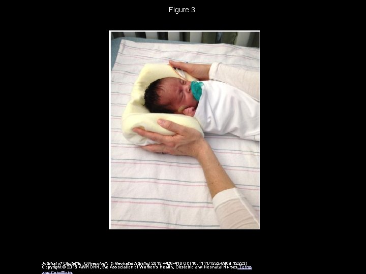 Prevention of Deformational Plagiocephaly in Hospitalized Infants Using