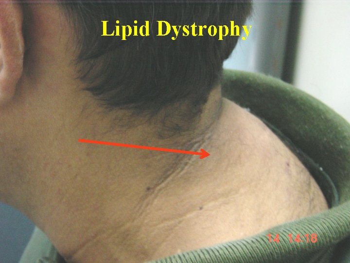 Patient Management and Case Presentation Cesar Augusto Migliorati