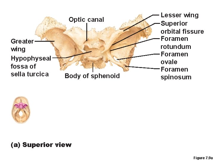 Skull Thoracic cage ribs and sternum Vertebral column