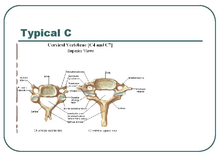 Vertebral Column Osteology and Arthrology Osteology l l