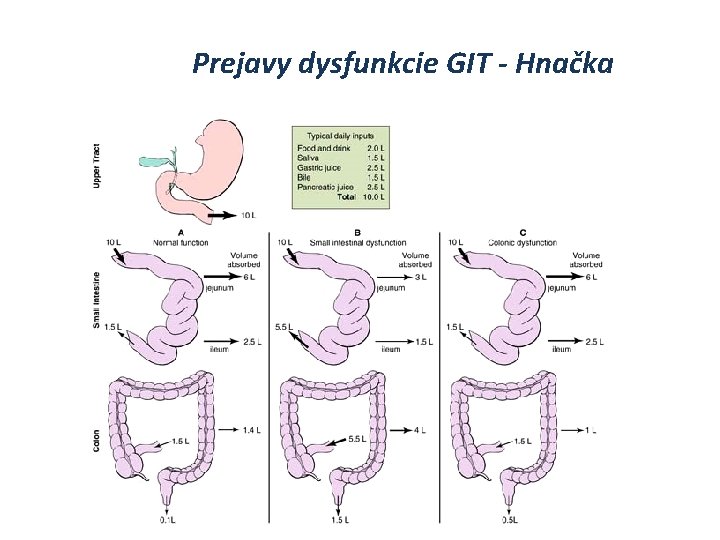 PATOFYZIOLGIA GIT Patogenza vredovej choroby aldka a duodena