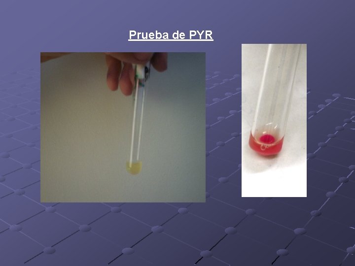 Pruebas bioqumicas de identificacin Prof Dr Marcos Colmn