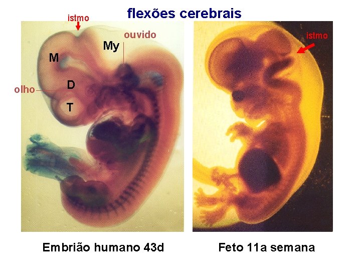 Embriologia humana Desenvolvimento do Sistema Nervoso Central Crista
