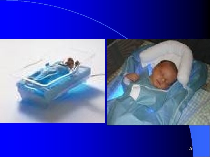 PRISE EN CHARGE DE LENFANT PRESENTANT UN ICTERE