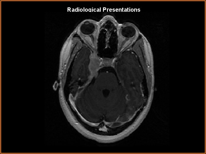 Radiological Category Neuroradiology Principal Modality 1 MRI Principal