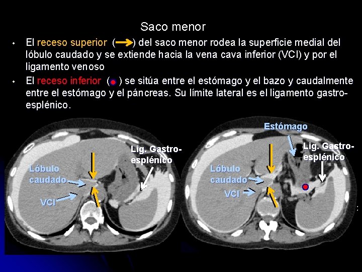 ANATOMA DEL PERITONEO Juan Calvo Blanco Rafael Menndez