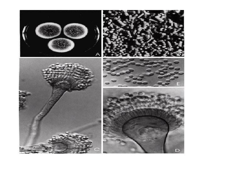 ASPERGILLOSIS Prof Khaled H AbuElteen ASPERGILLOSIS Aspergilli produce