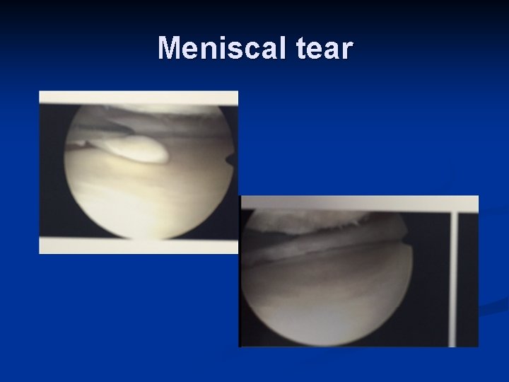Young Adult Knee Injuries Mr Hersh Deo MB