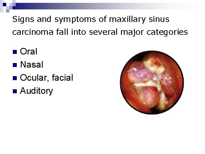 Sinonasal Tumours n Tumors of the nasal cavity