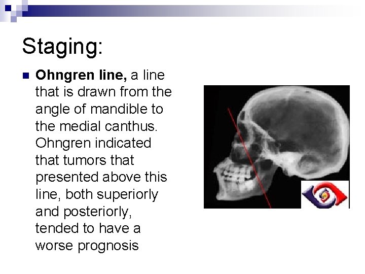 Sinonasal Tumours n Tumors of the nasal cavity