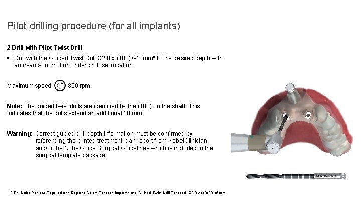 Pilot Drilling procedure for all implants including Nobel