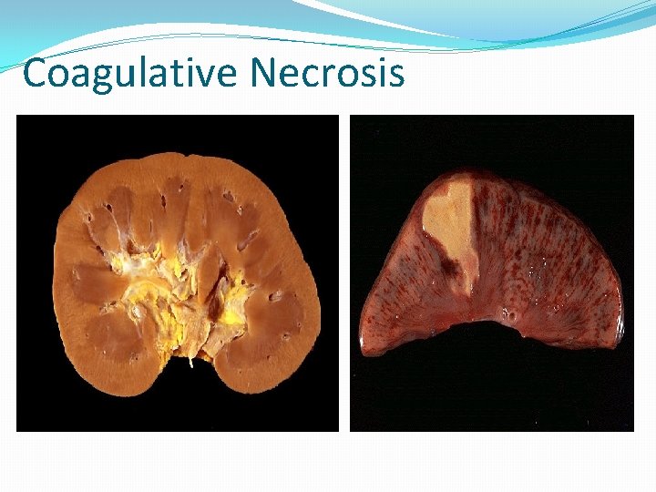KOWNAYN UNIVERSITY SYSTEMIC PATHOLOGY Mr Ahmed Abdirizak Chapter