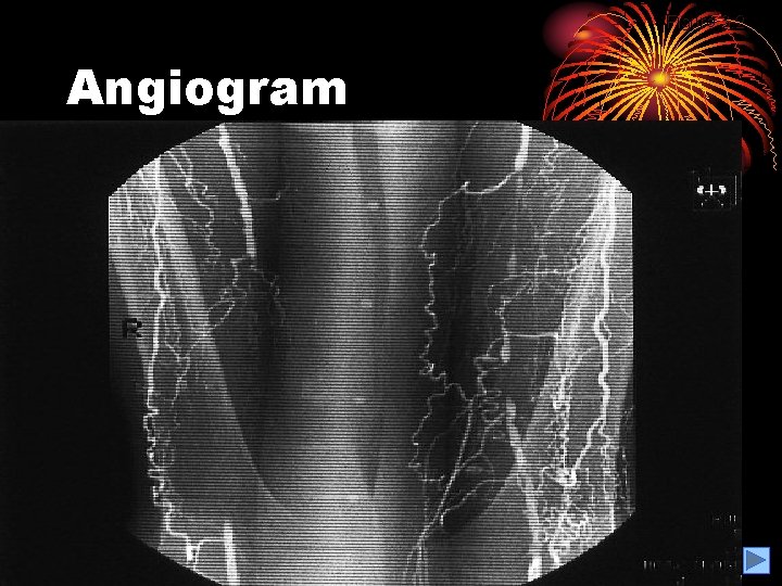 Pulse Examination Femoral A Popliteal A Dorsalis pedis