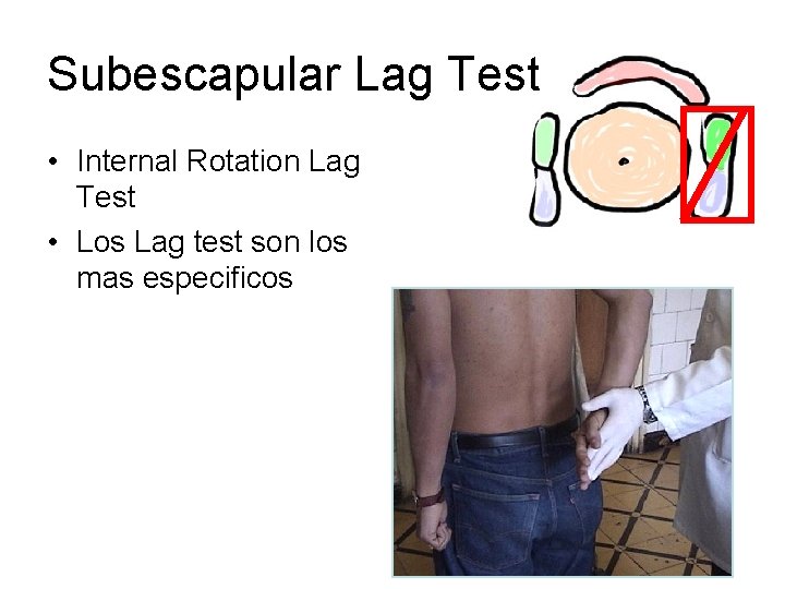 Examen Fsico De Hombro Dr Francisco Soza Equipo