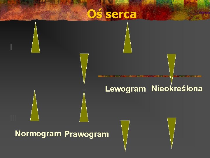 PODSTAWY EKG Renata Gwczyska I Katedra i Klinika