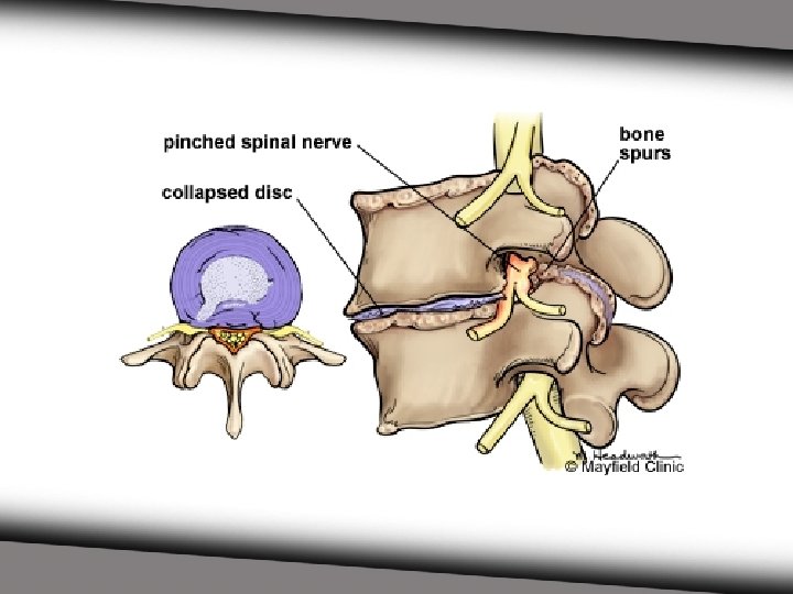 LOW BACK PAIN Dr Zachary Stelmack ANATOMY OF