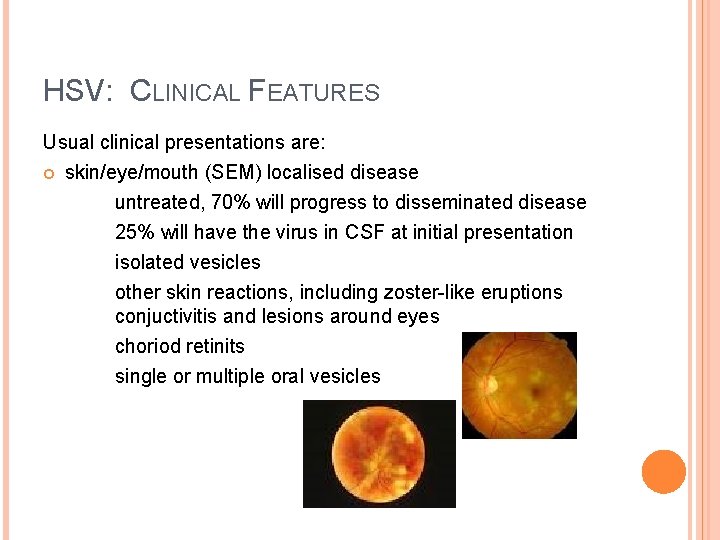 NEONATAL SEPSIS BY NICOLE STEVENS NEONATAL SEPSIS Definition
