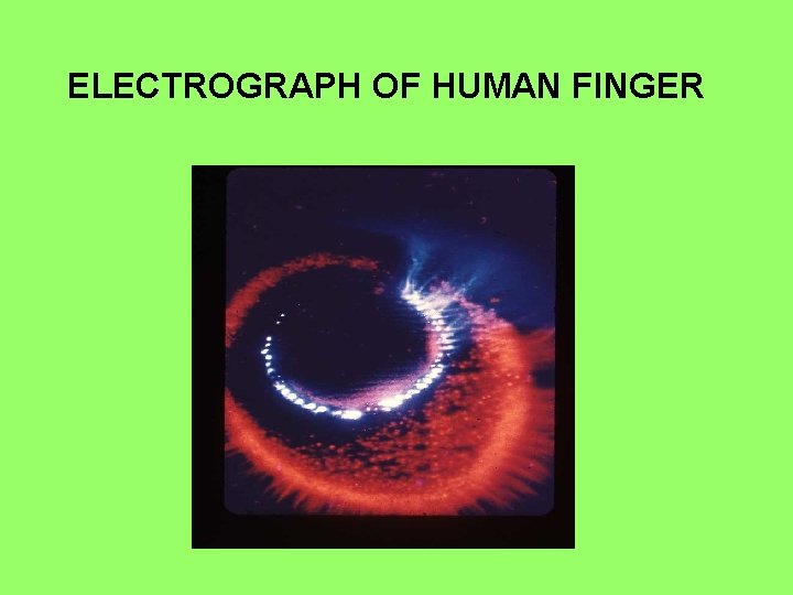 RESONANCE FREQUENCY BASED CONDUCTIVITY AS A NEW MEASURE
