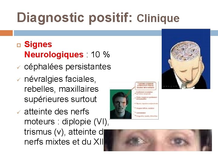 CANCER DU CAVUM Pr M Benchaoui Matre de