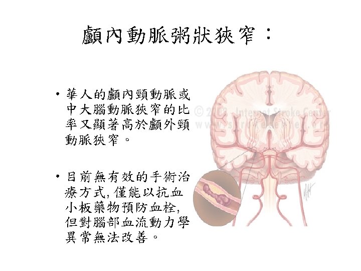 Intracranial PTAstenting ECIC Bypass STAMCA bypass Graft to