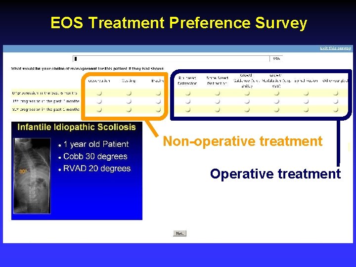 Finding the Tipping Point When Should Surgery Be