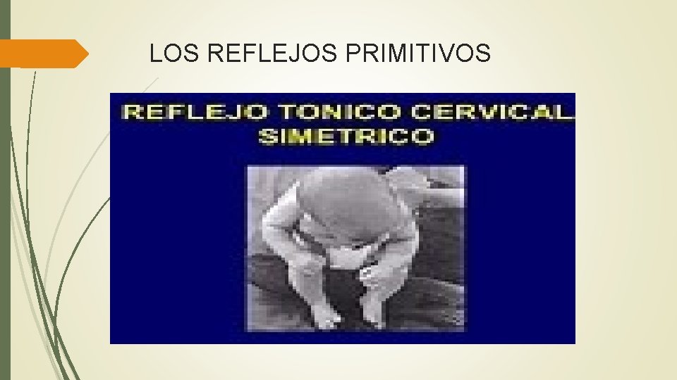 SIGNOS DE ALARMA Y NEURODESARROLLO FACTORES A TENER