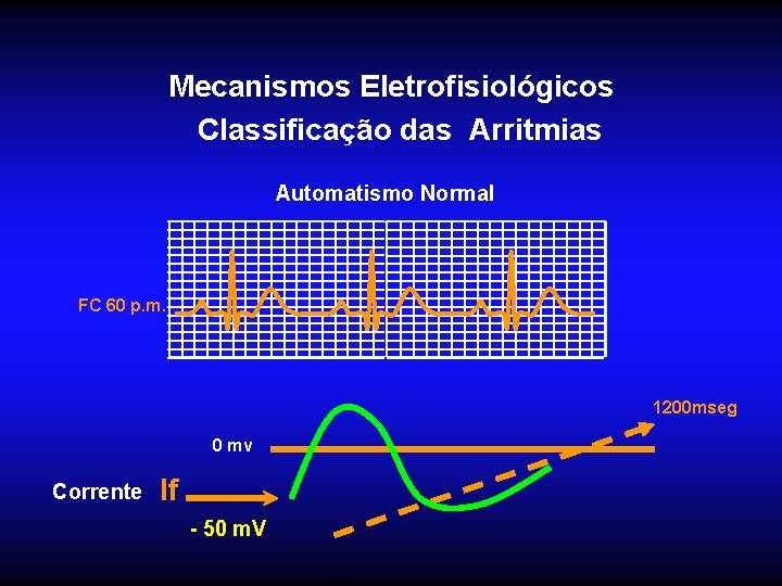 Eletrocardiografia Clnica MDULO XII Mecanismos Eletrofisiolgicos ...